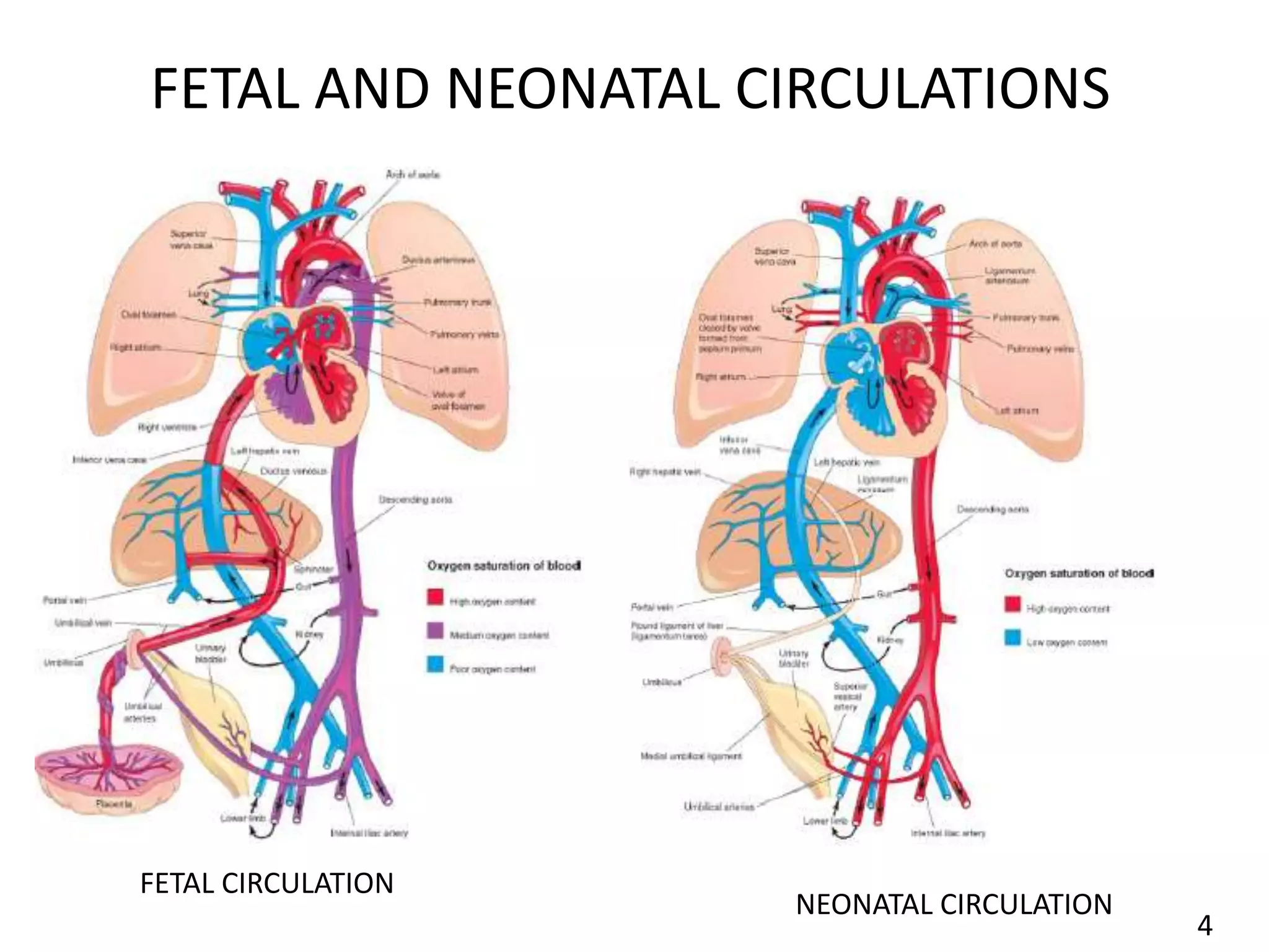 Fetal And Neonatal Circulation Lecturepptx