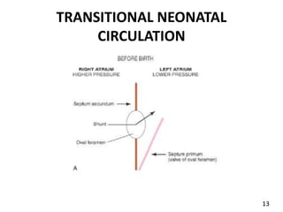 FETAL AND NEONATAL CIRCULATION lecture.pptx