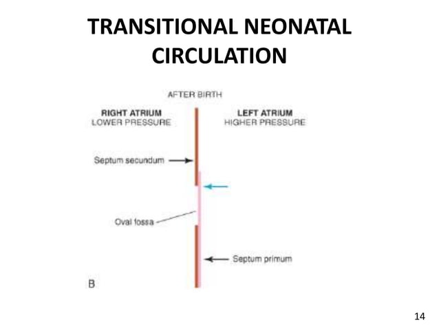 FETAL AND NEONATAL CIRCULATION lecture.pptx | Pregnancy | Reproductive ...