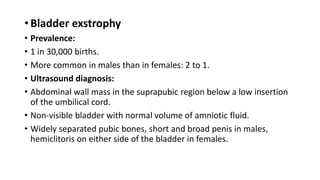 Ultrasound of Fetal anomalies in first trimester | PPTX