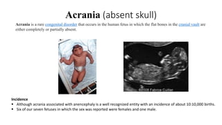 Ultrasound of Fetal anomalies in first trimester | PPTX