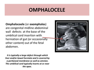 Fetal anomaly archive advanced usg lounge | PPTX