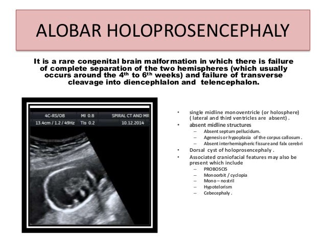Fetal anomaly archive advanced usg lounge