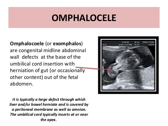 Fetal anomaly archive advanced usg lounge