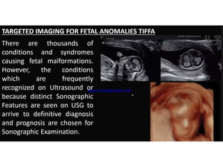 First trimester fetal anomaly scan and beyond part 2 .pptx