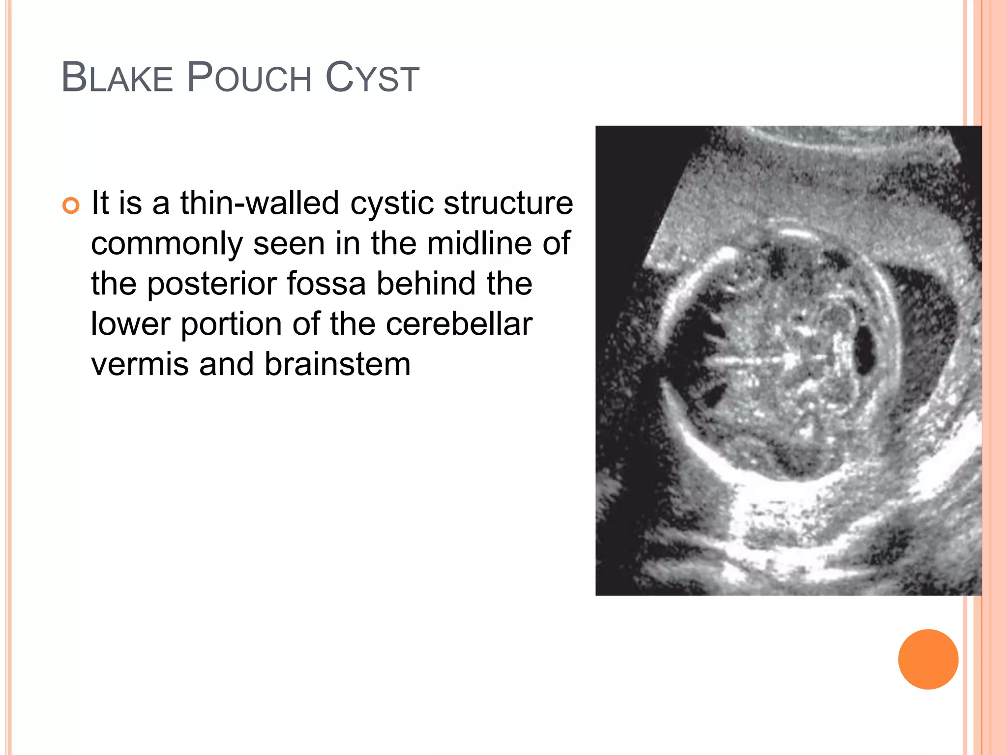 Fetal anomaly scan | PPTX