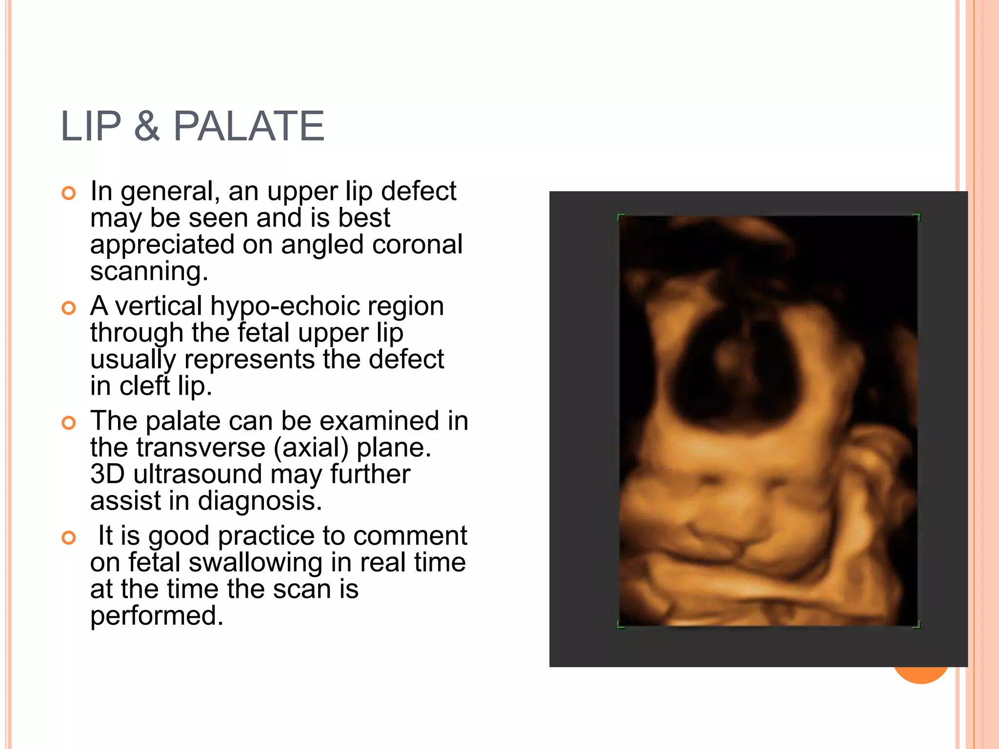 Fetal anomaly scan | PPTX | Pregnancy | Reproductive Health