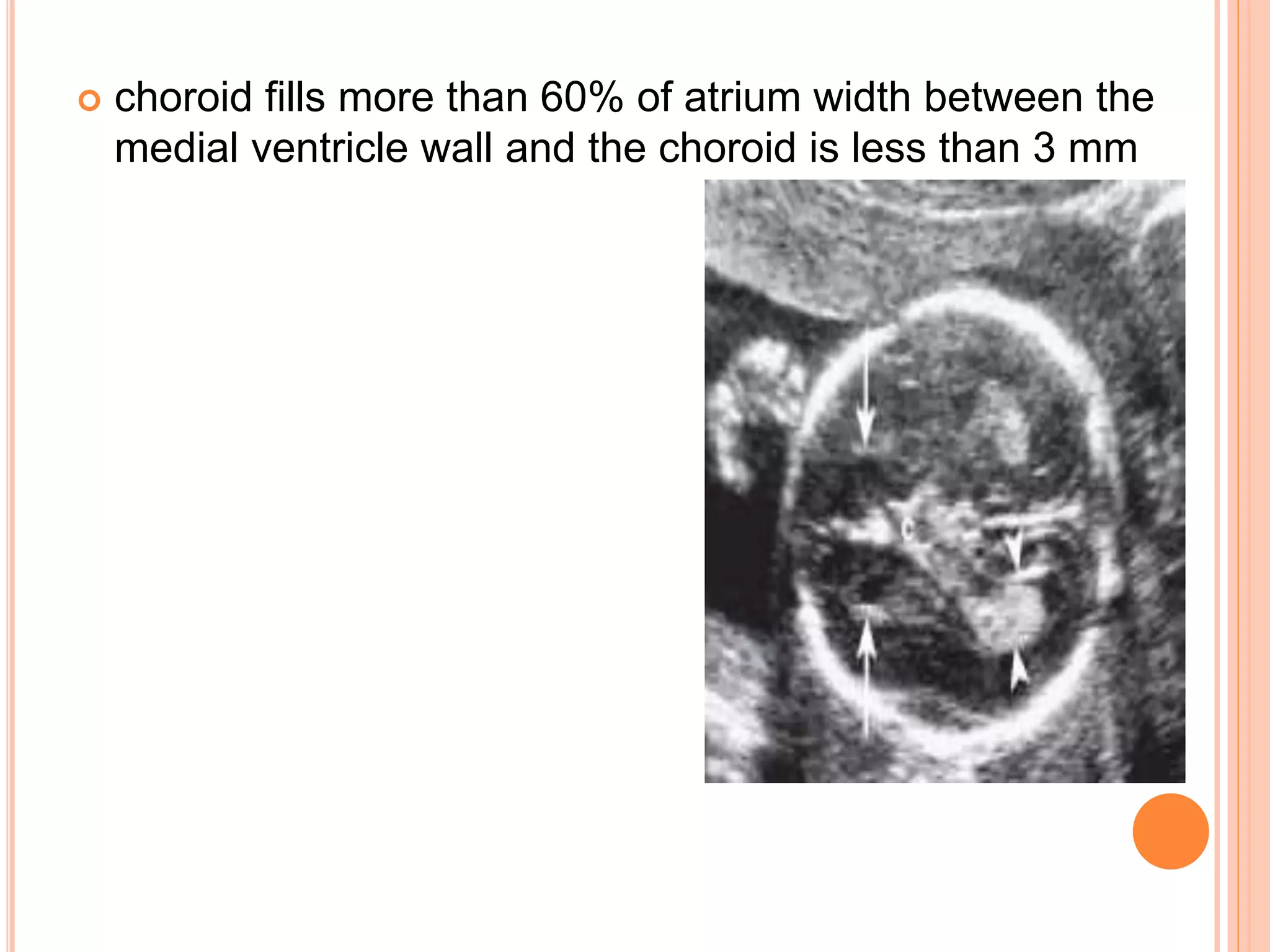 Fetal anomaly scan | PPTX | Pregnancy | Reproductive Health