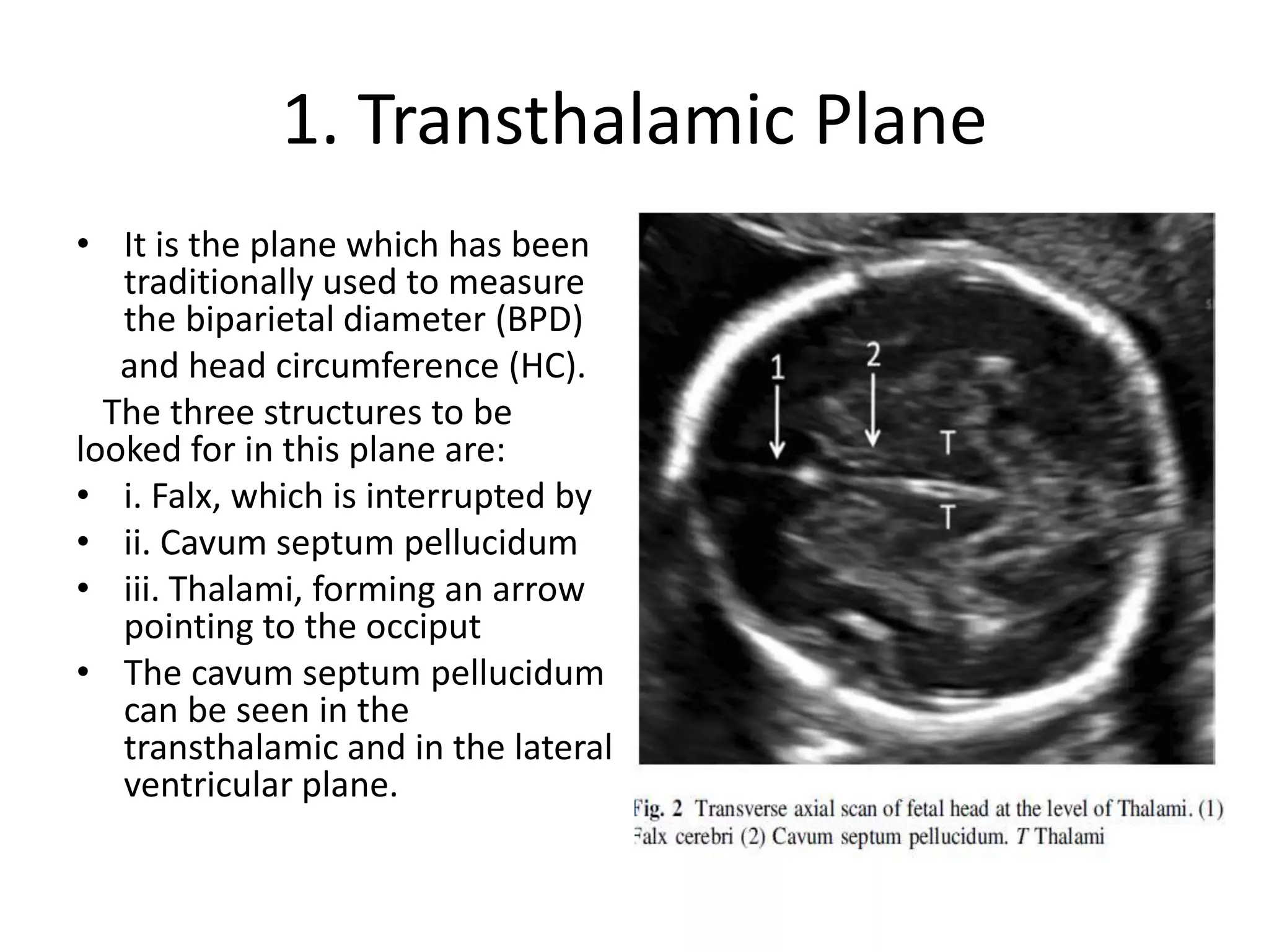 Fetal anomaly scan | PPTX | Pregnancy | Reproductive Health
