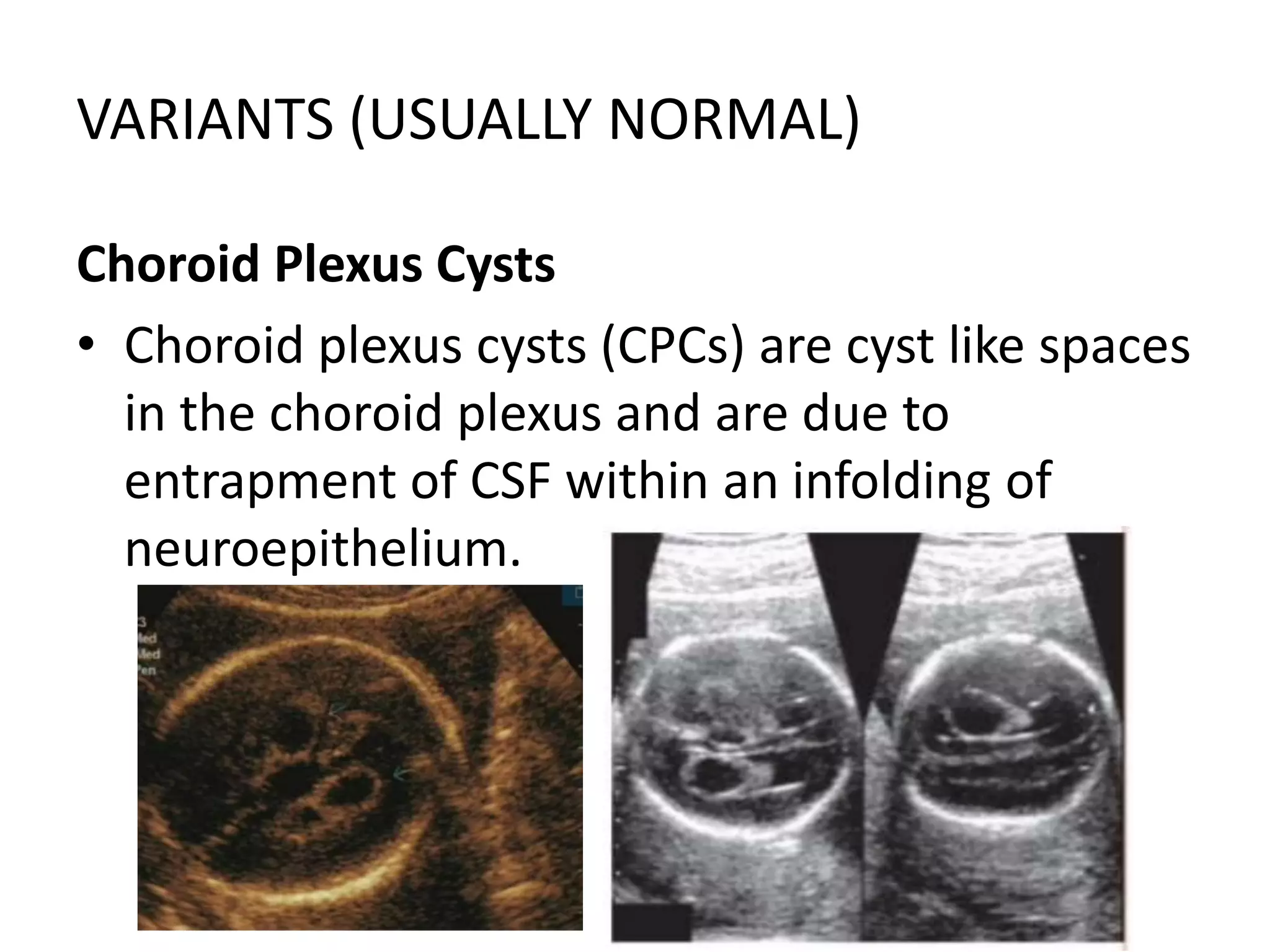 Fetal anomaly scan | PPTX | Pregnancy | Reproductive Health