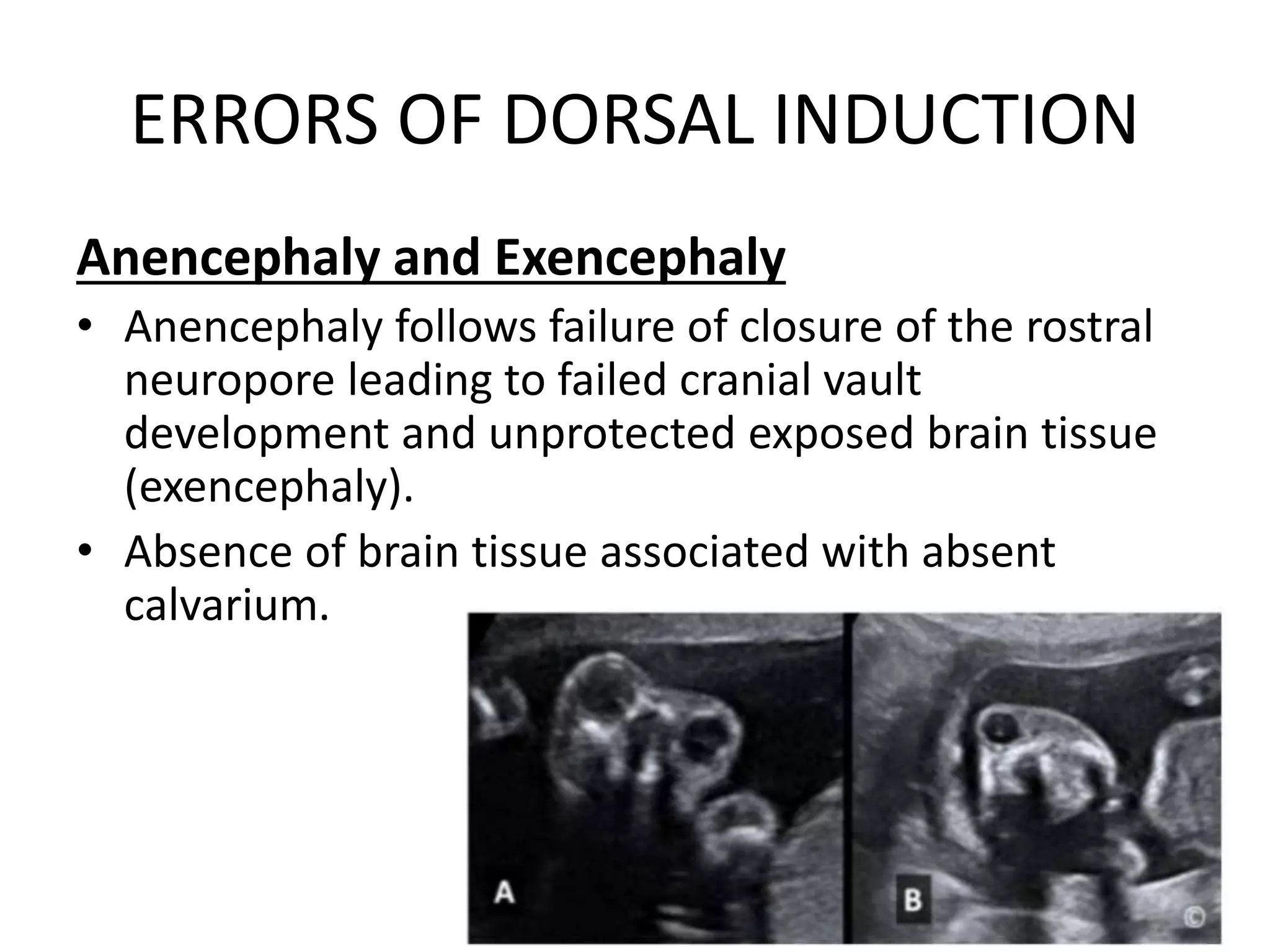 Fetal anomaly scan | PPTX | Pregnancy | Reproductive Health