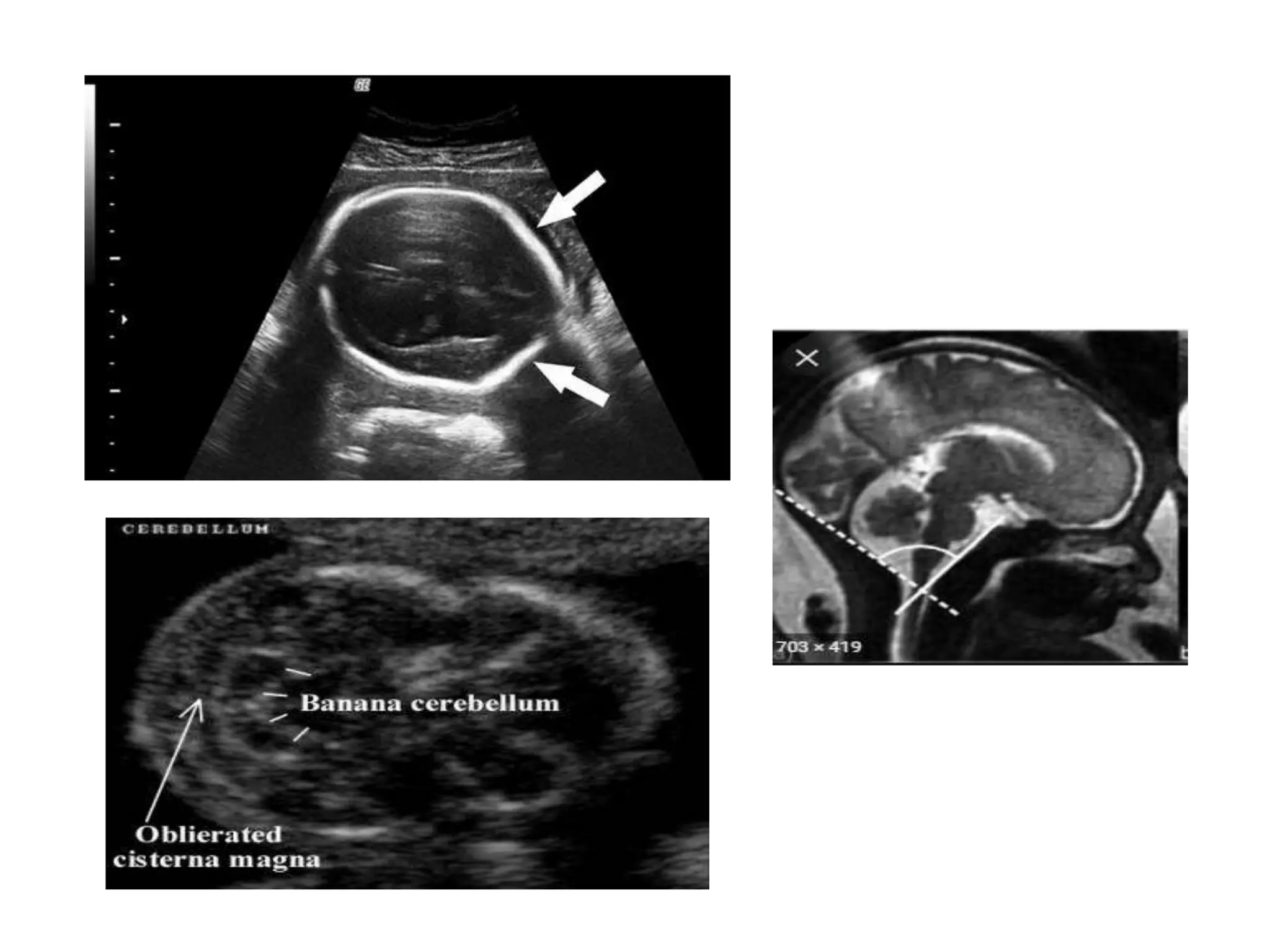 Fetal anomaly scan | PPTX | Pregnancy | Reproductive Health