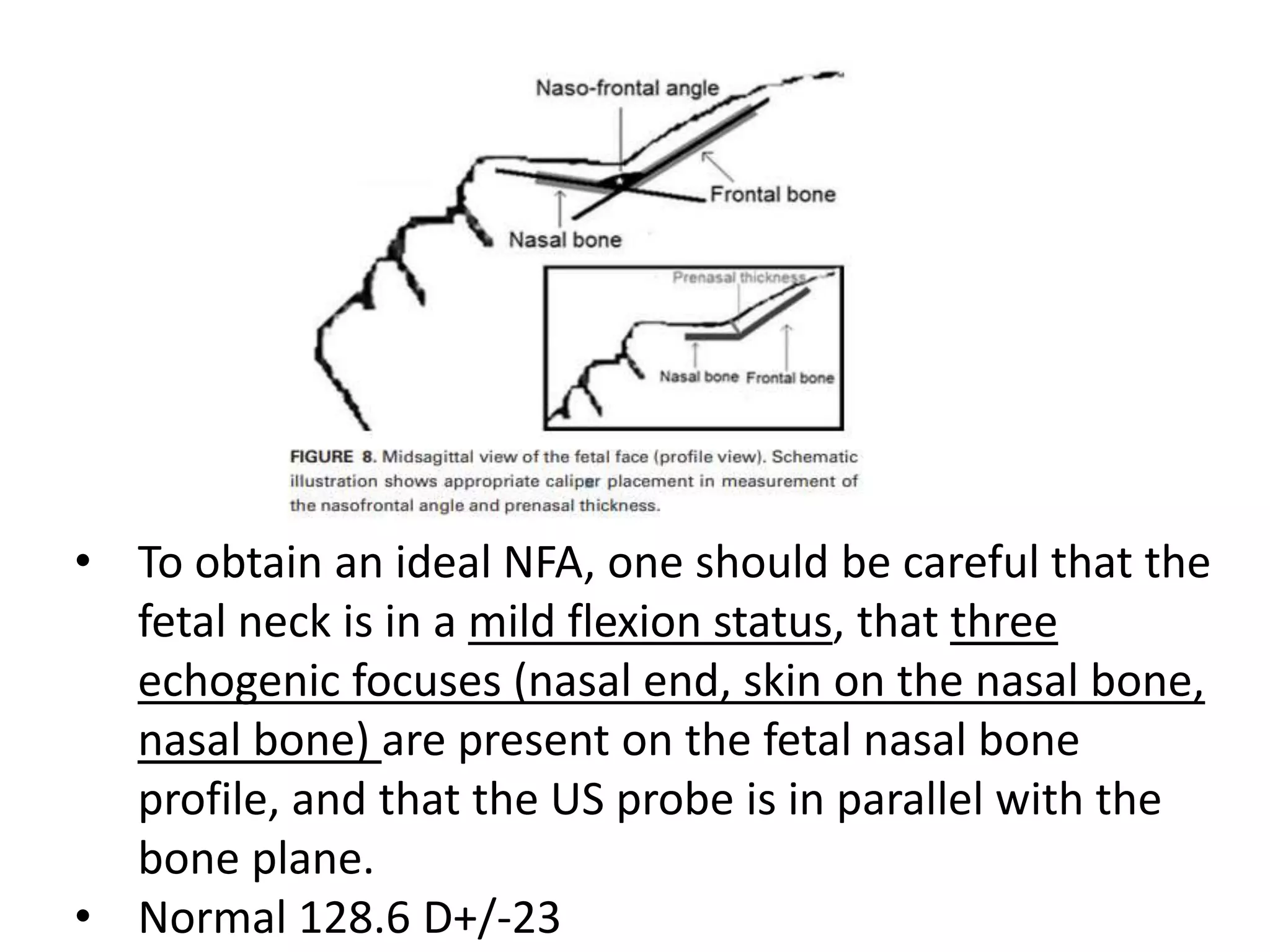 Fetal anomaly scan | PPTX | Pregnancy | Reproductive Health