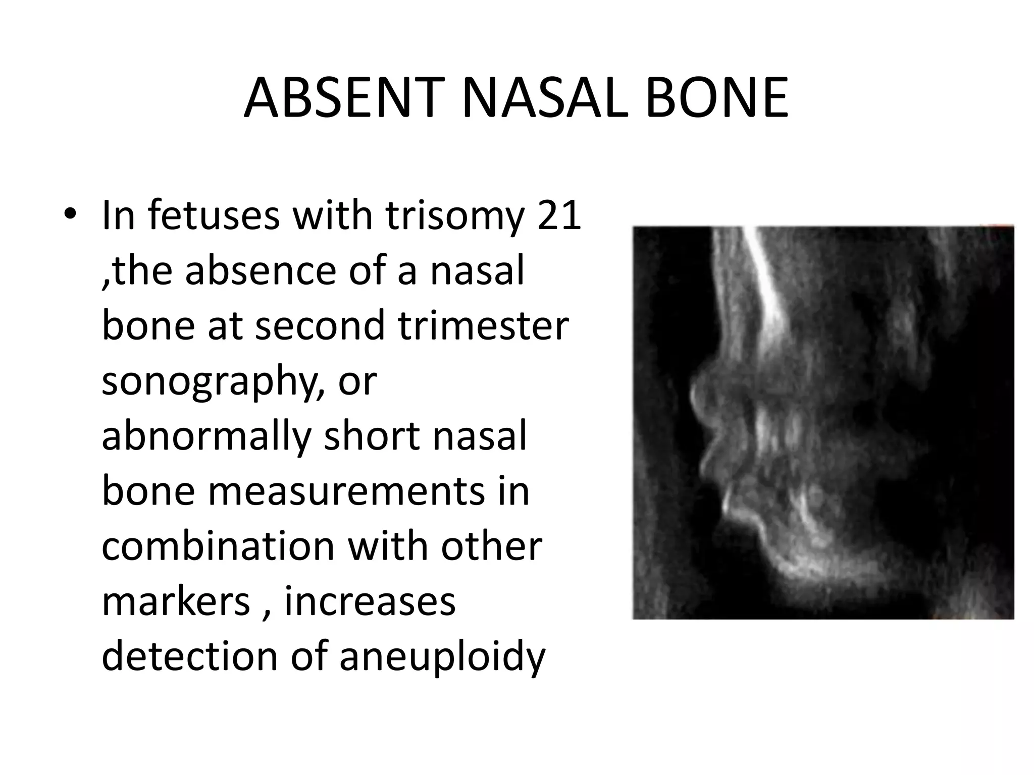 Fetal anomaly scan | PPTX