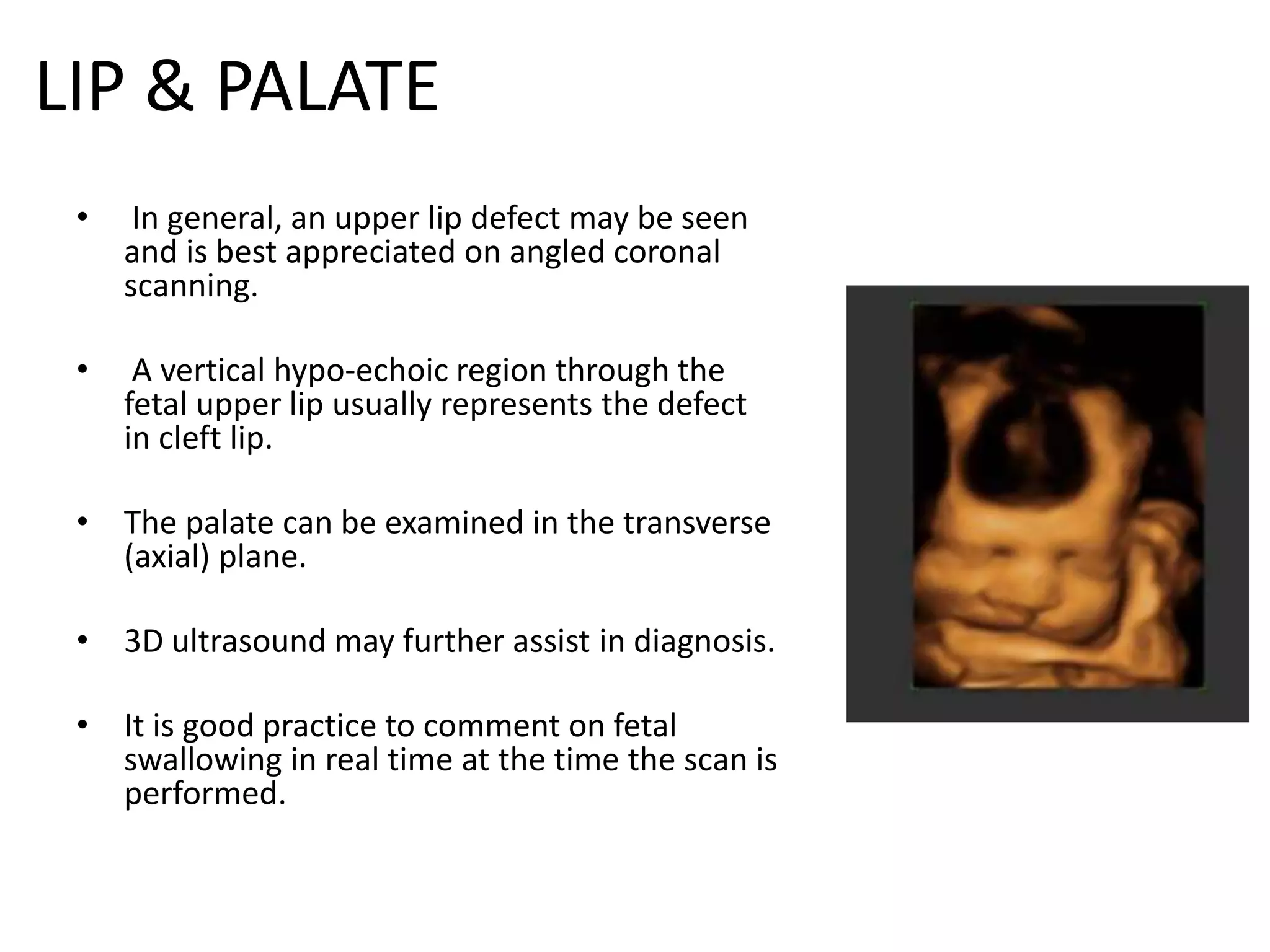 Fetal anomaly scan | PPTX | Pregnancy | Reproductive Health