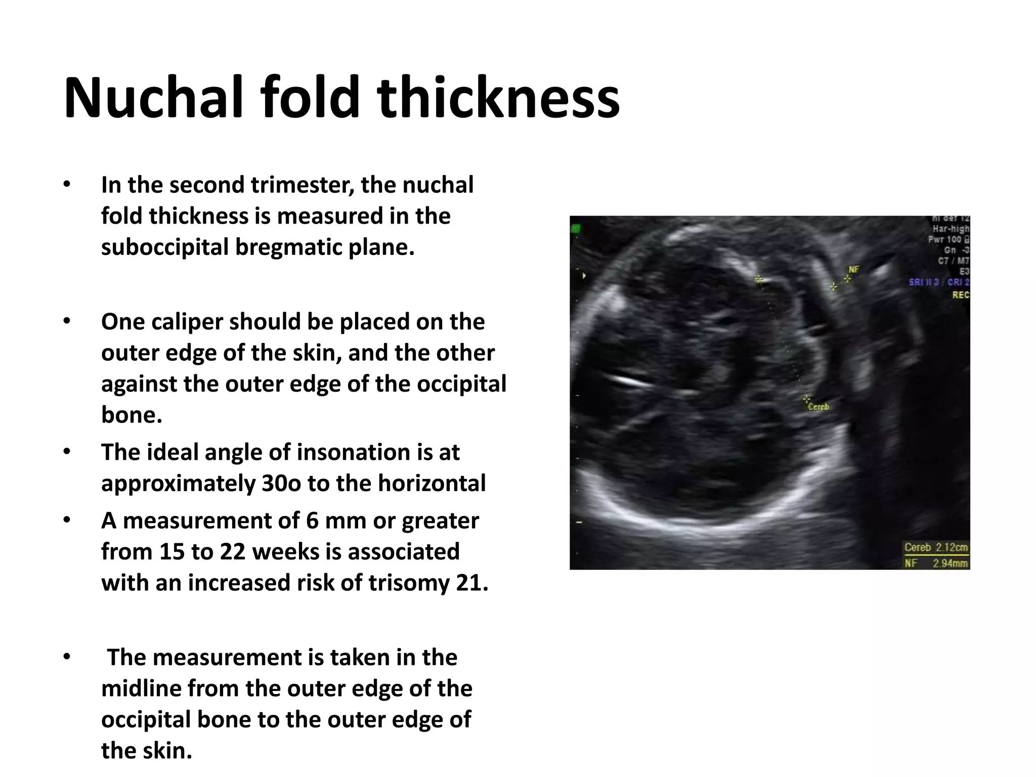 Fetal anomaly scan | PPTX