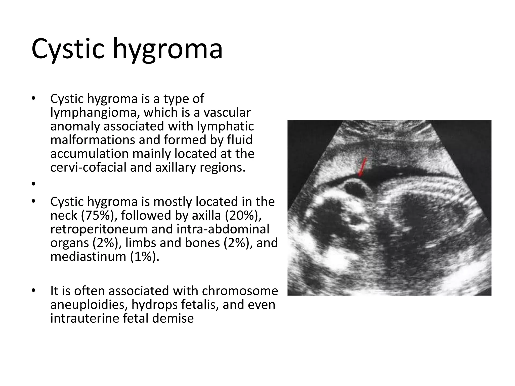 Fetal anomaly scan | PPTX