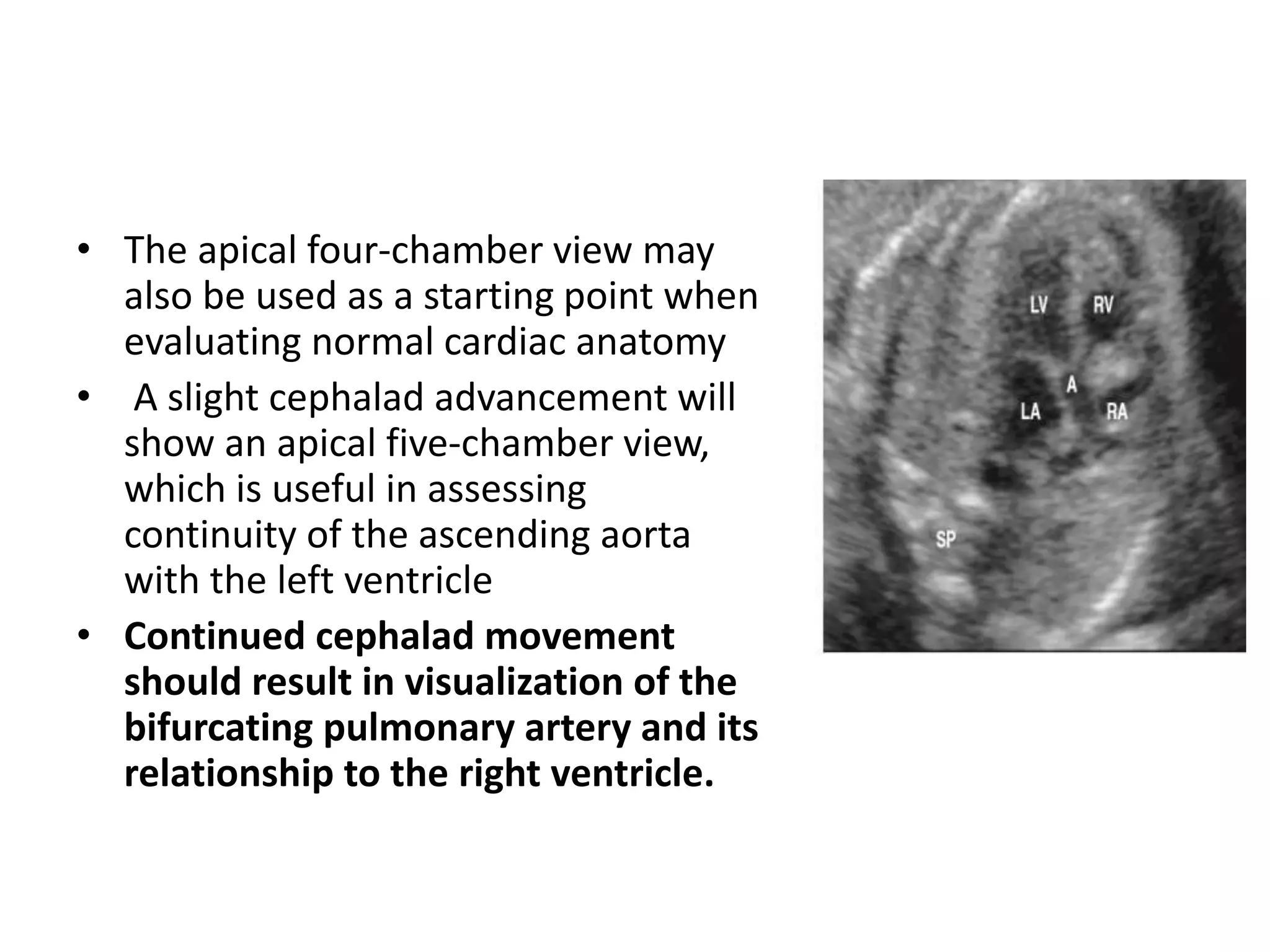 Fetal anomaly scan | PPTX