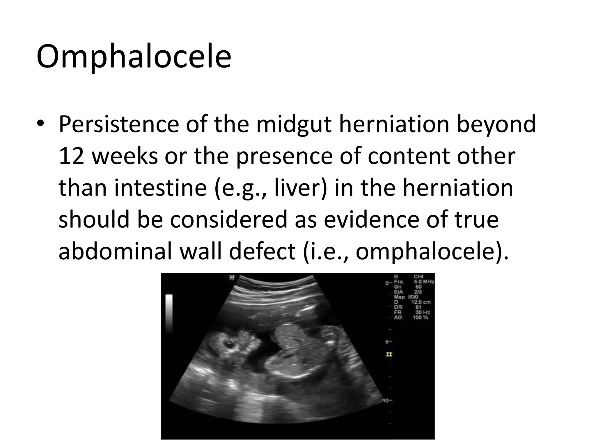 Fetal anomaly scan | PPTX