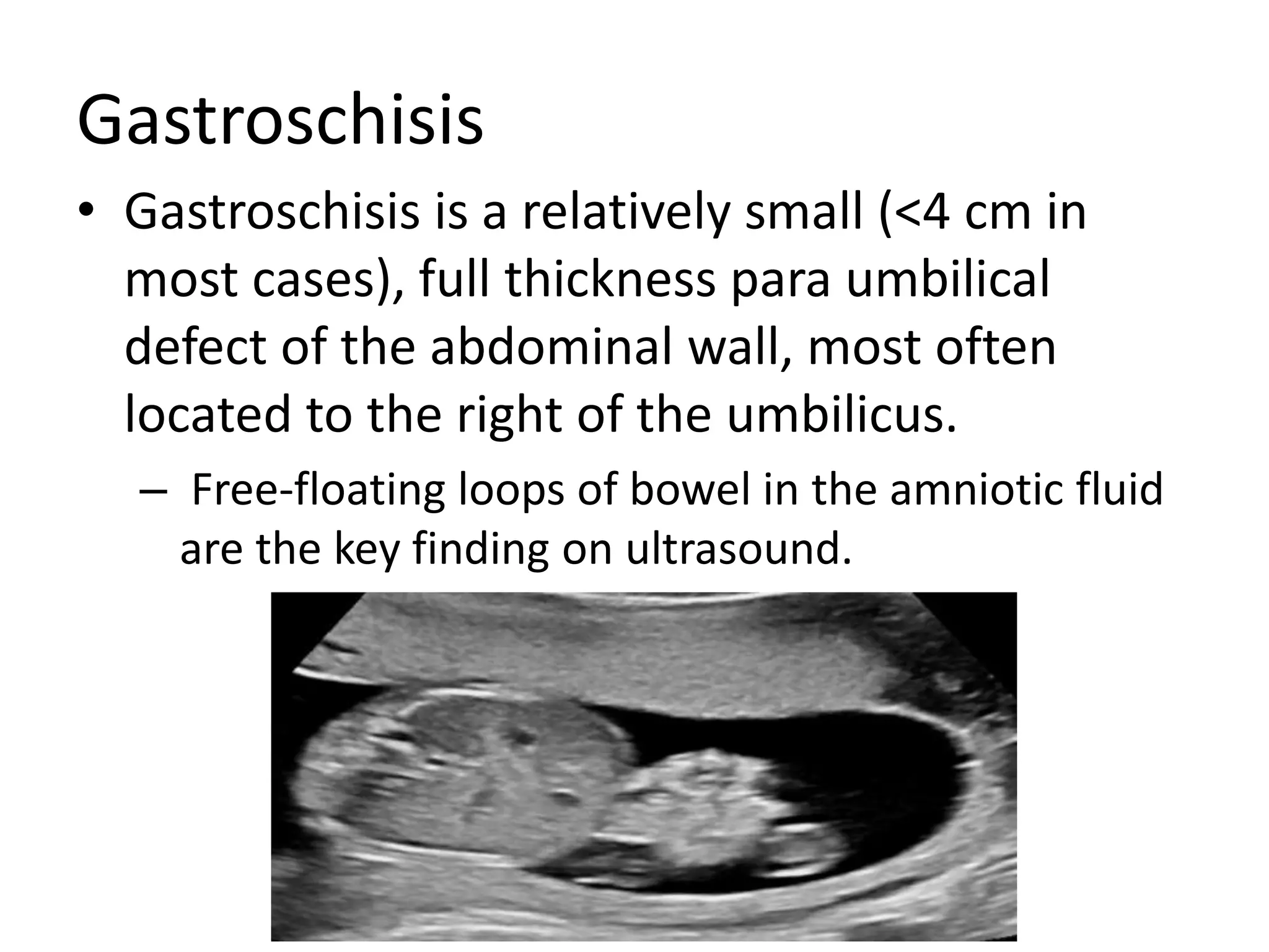 Fetal anomaly scan | PPTX