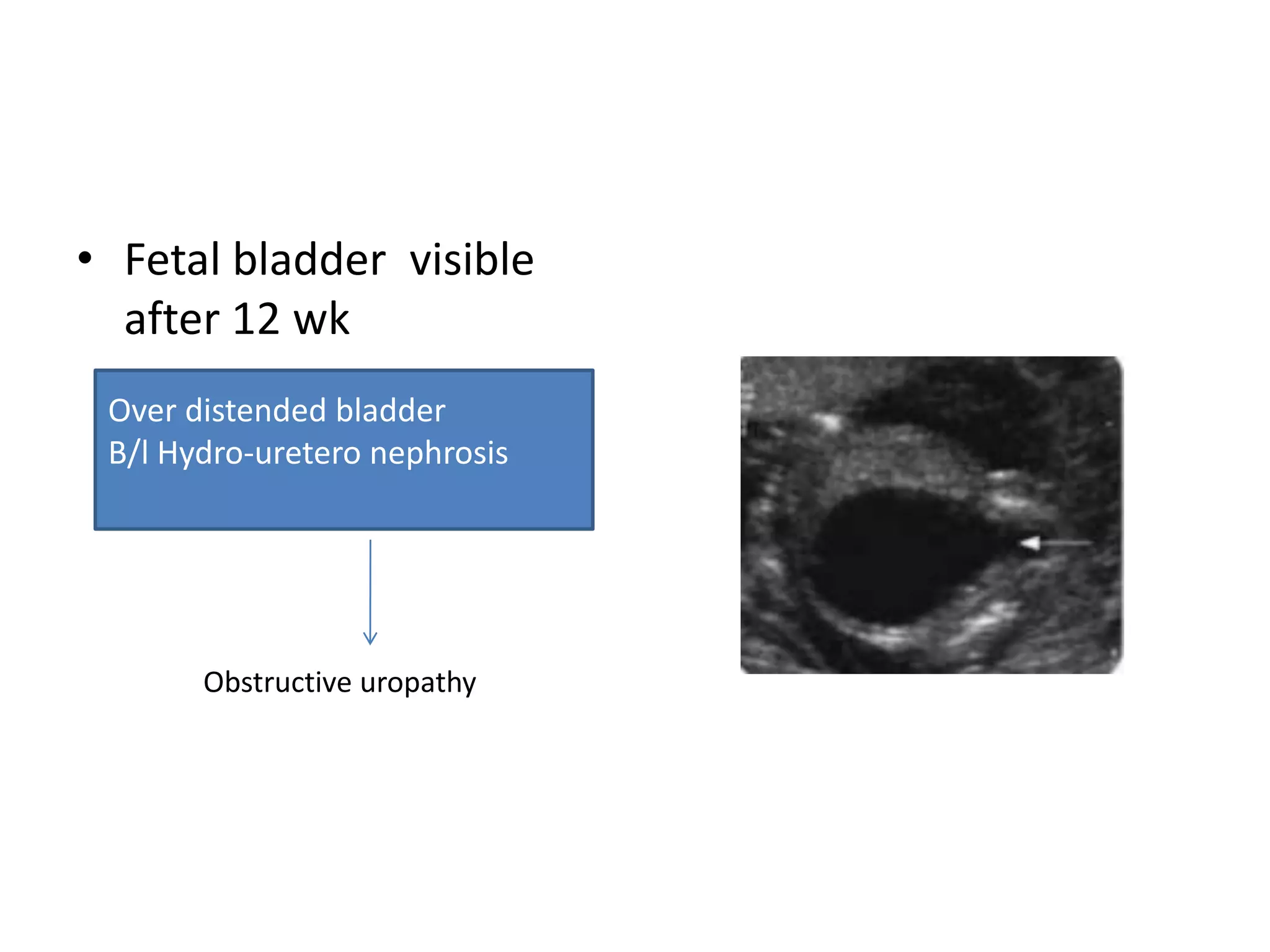 Fetal anomaly scan | PPTX