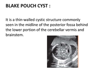 Fetal anomaly scan | PPTX