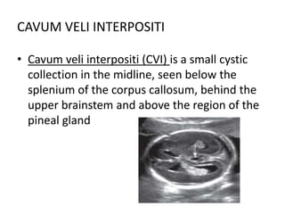 Fetal anomaly scan | PPTX