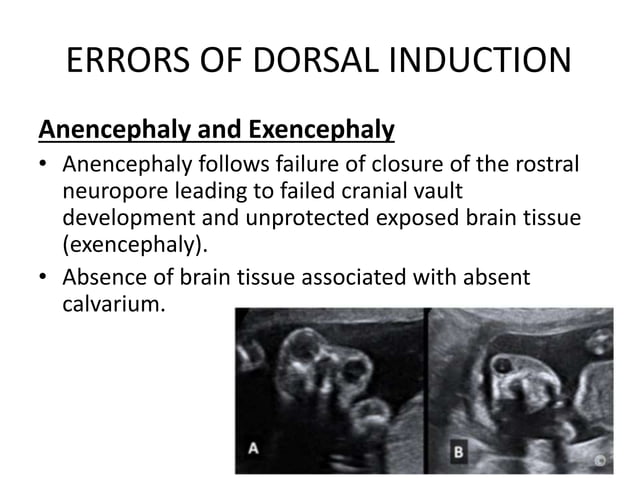 Fetal anomaly scan | PPTX | Pregnancy | Reproductive Health