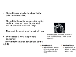 Fetal anomaly scan | PPTX
