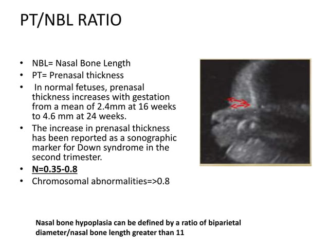 Fetal anomaly scan | PPTX | Pregnancy | Reproductive Health