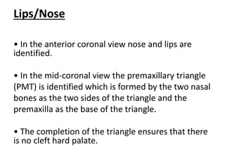 Fetal anomaly scan | PPTX