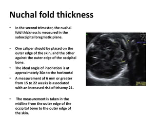 Fetal anomaly scan | PPTX