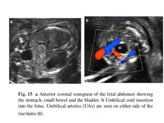 Fetal anomaly scan | PPTX