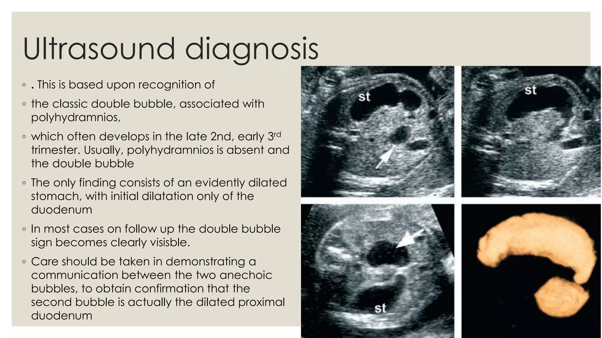 Fetal anomaly scan pt2 | PPTX