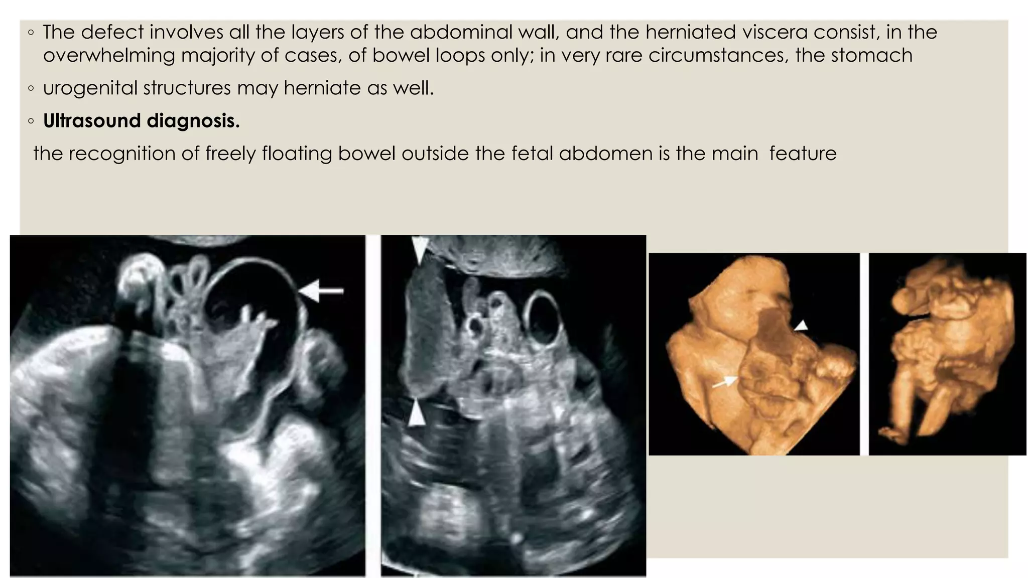 Fetal anomaly scan pt2 | PPTX