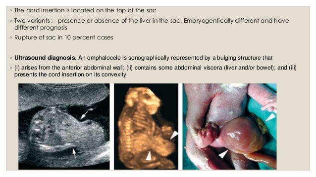 Fetal anomaly scan pt2
