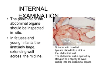 fetalautopsy-1.pptx