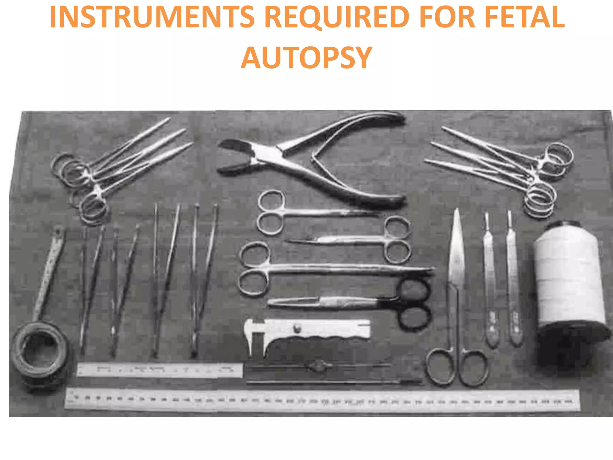 Fetal autopsy | PPTX