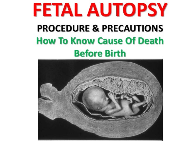 Fetal autopsy