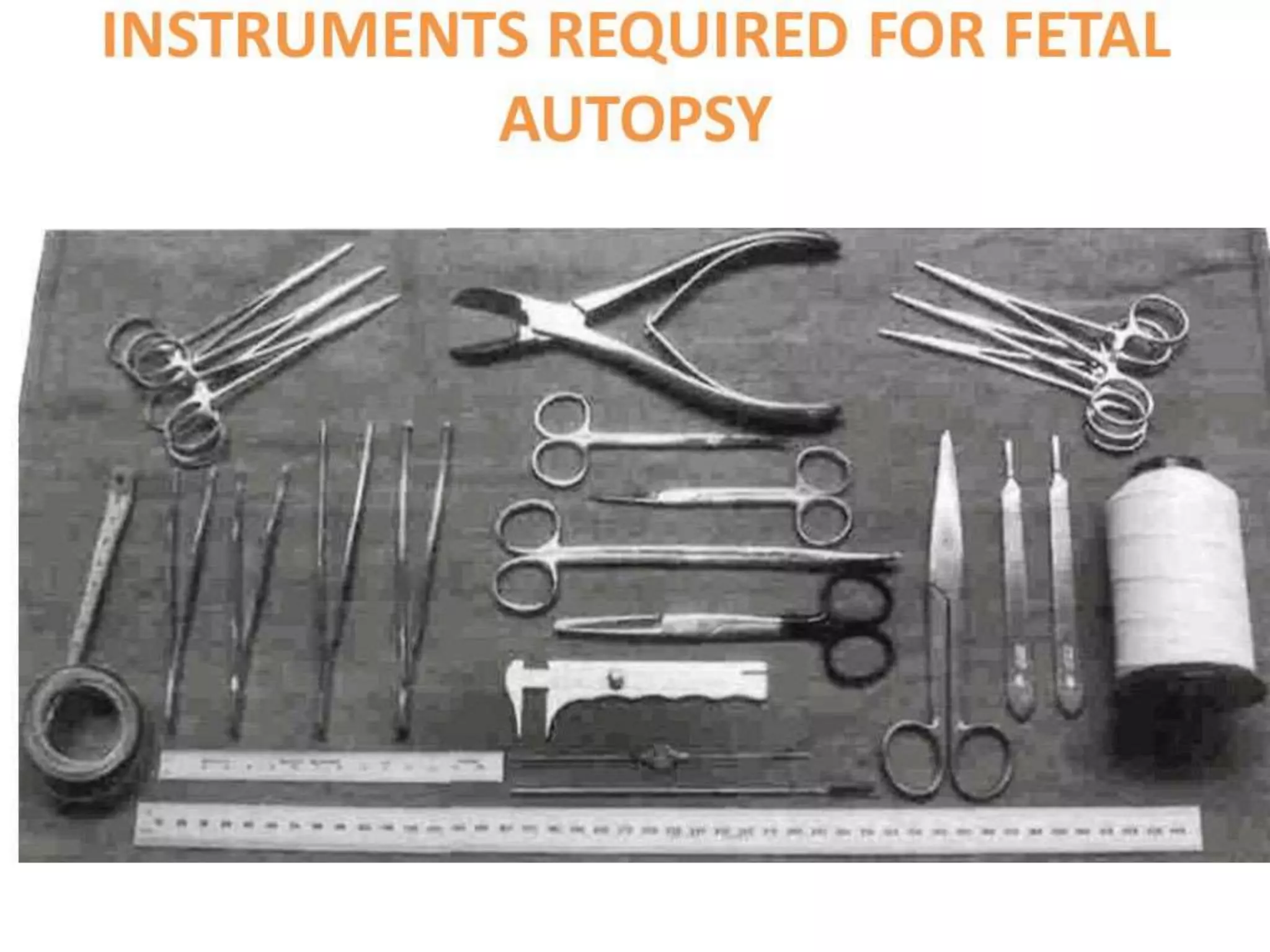 Fetal autopsy | PPTX