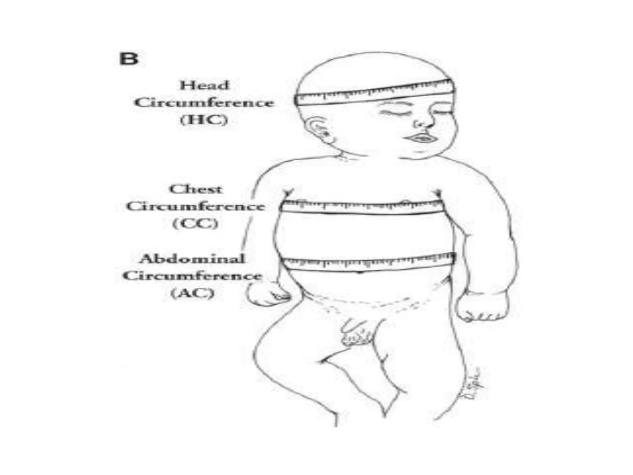 Fetal autopsy | PPTX