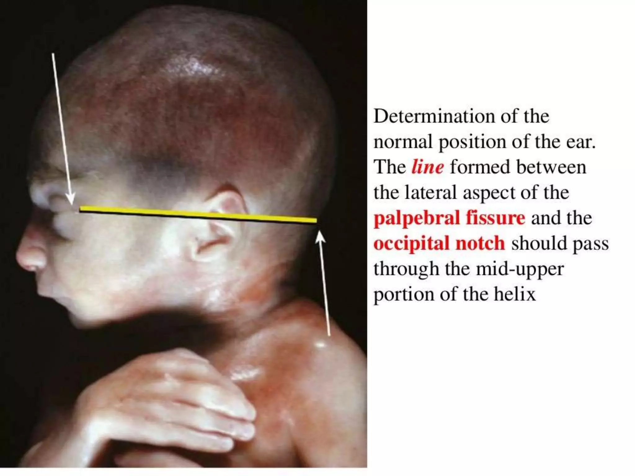 Fetal autopsy | PPTX | Pregnancy | Reproductive Health