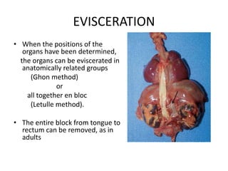 Fetal autopsy | PPTX