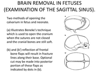 Fetal autopsy | PPTX