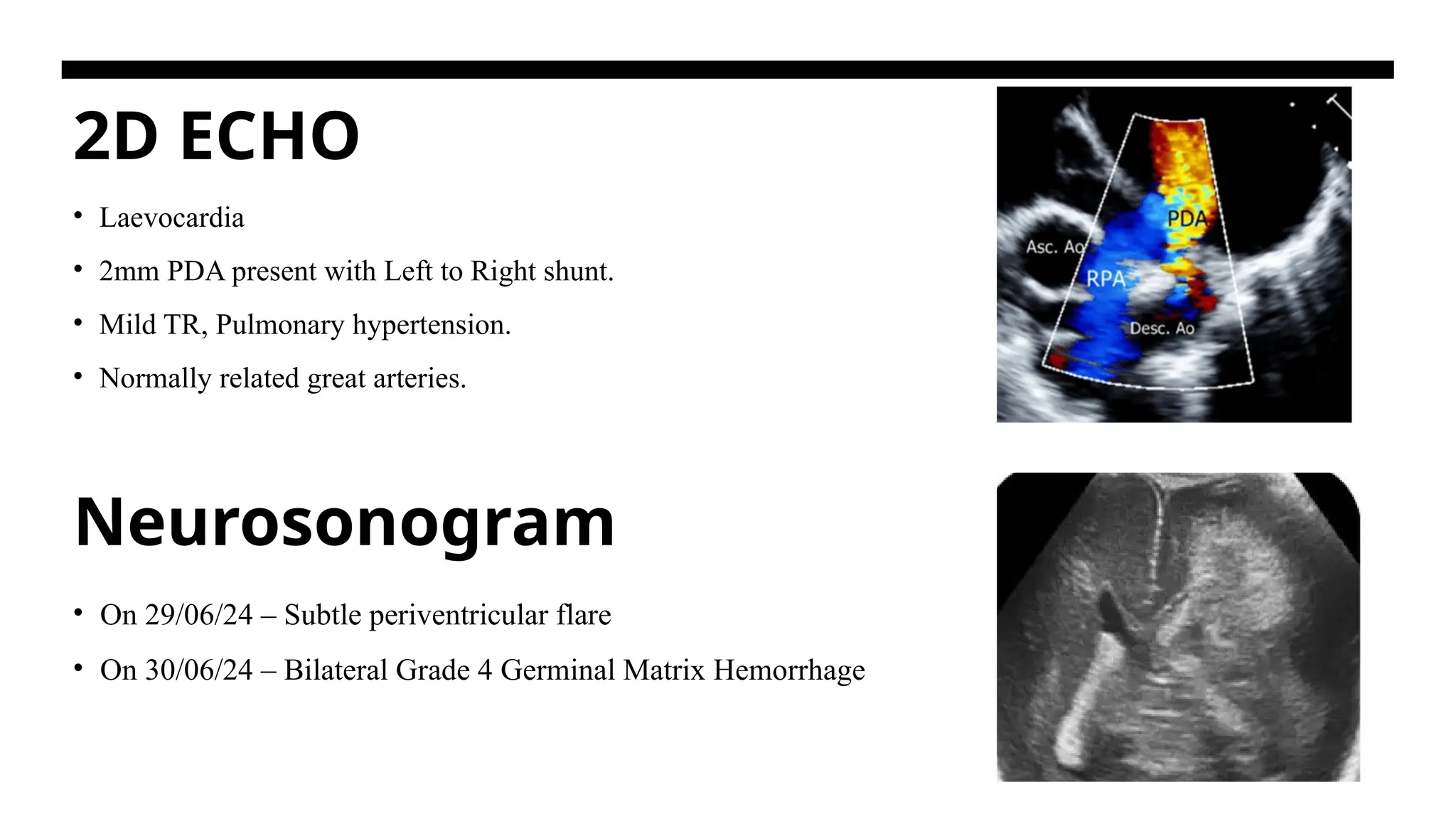Comprehensive Fetal Autopsy in a Case of Prematurity with Patent Ductus ...