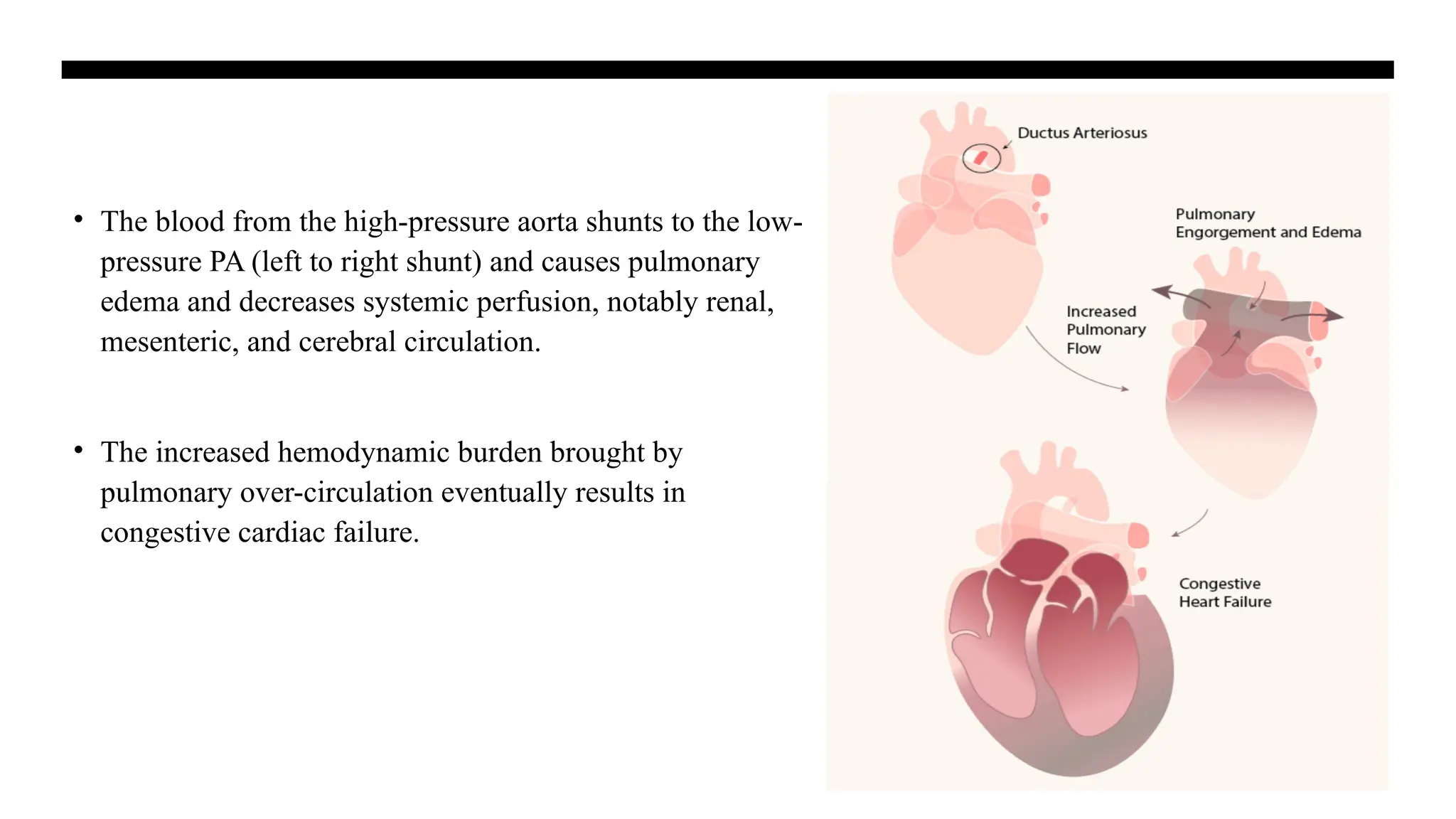 Comprehensive Fetal Autopsy in a Case of Prematurity with Patent Ductus ...