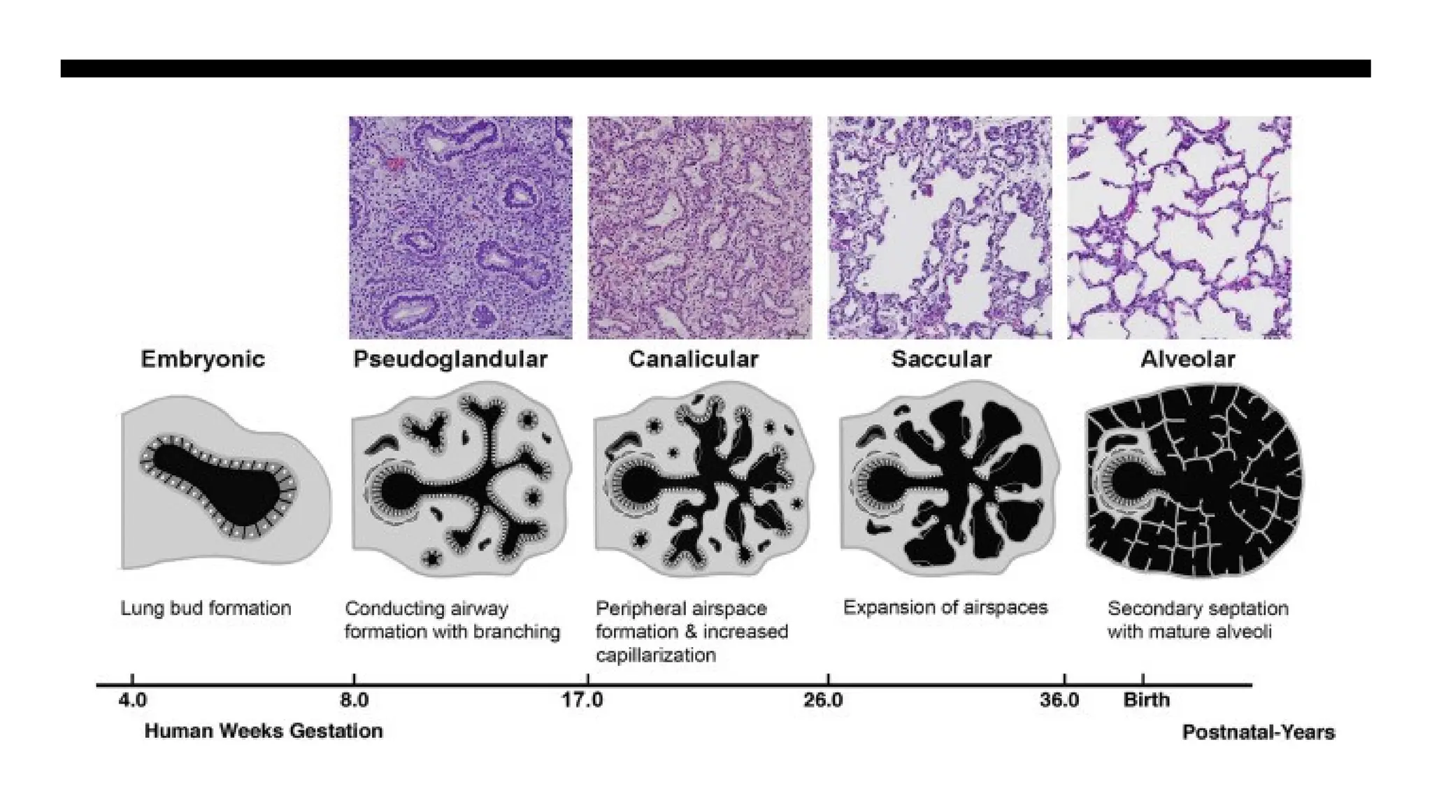 Comprehensive Fetal Autopsy in a Case of Prematurity with Patent Ductus ...