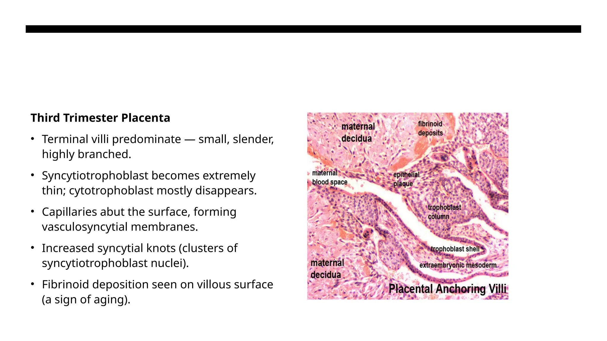 Comprehensive Fetal Autopsy in a Case of Prematurity with Patent Ductus ...