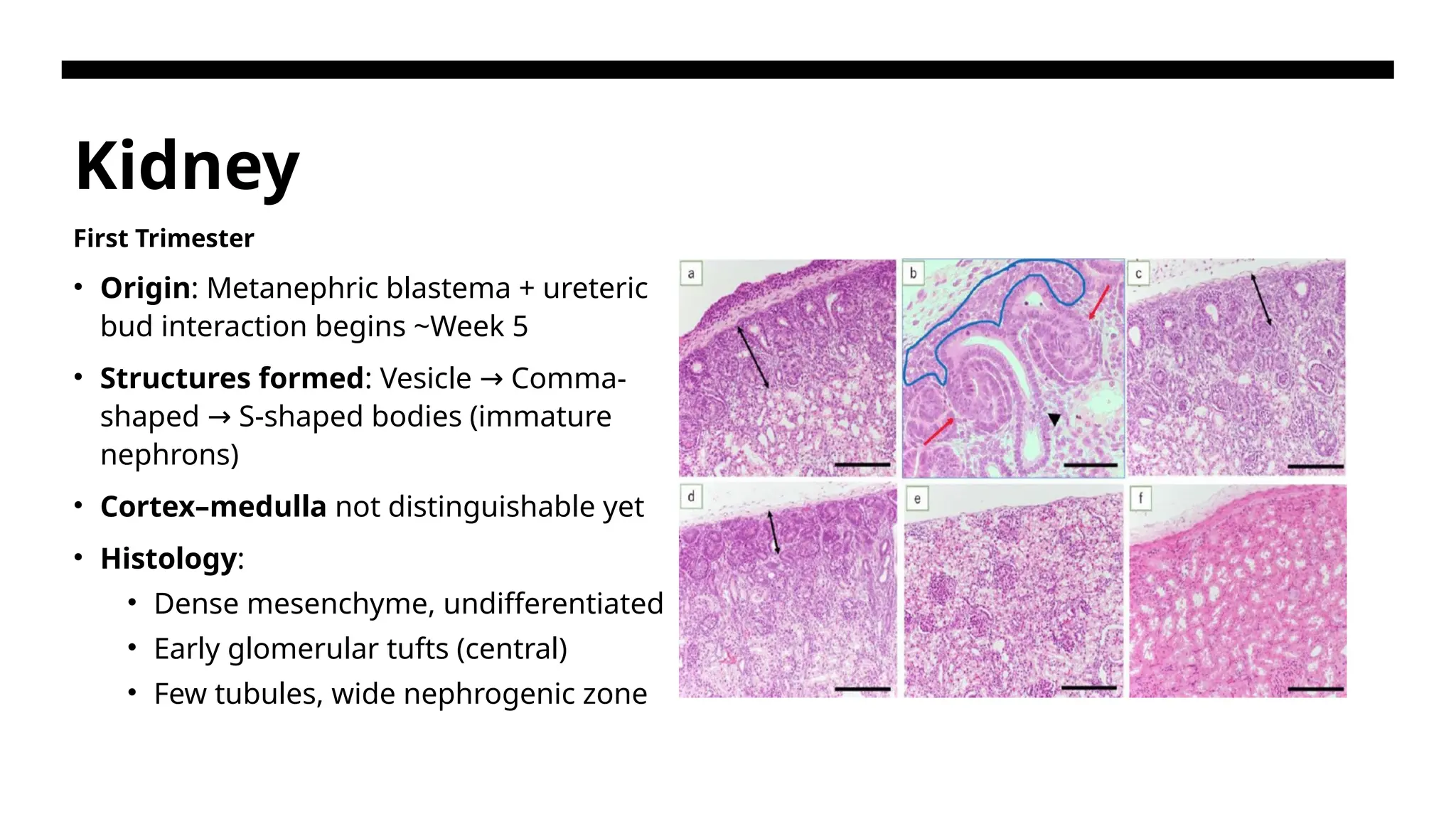 Comprehensive Fetal Autopsy in a Case of Prematurity with Patent Ductus ...
