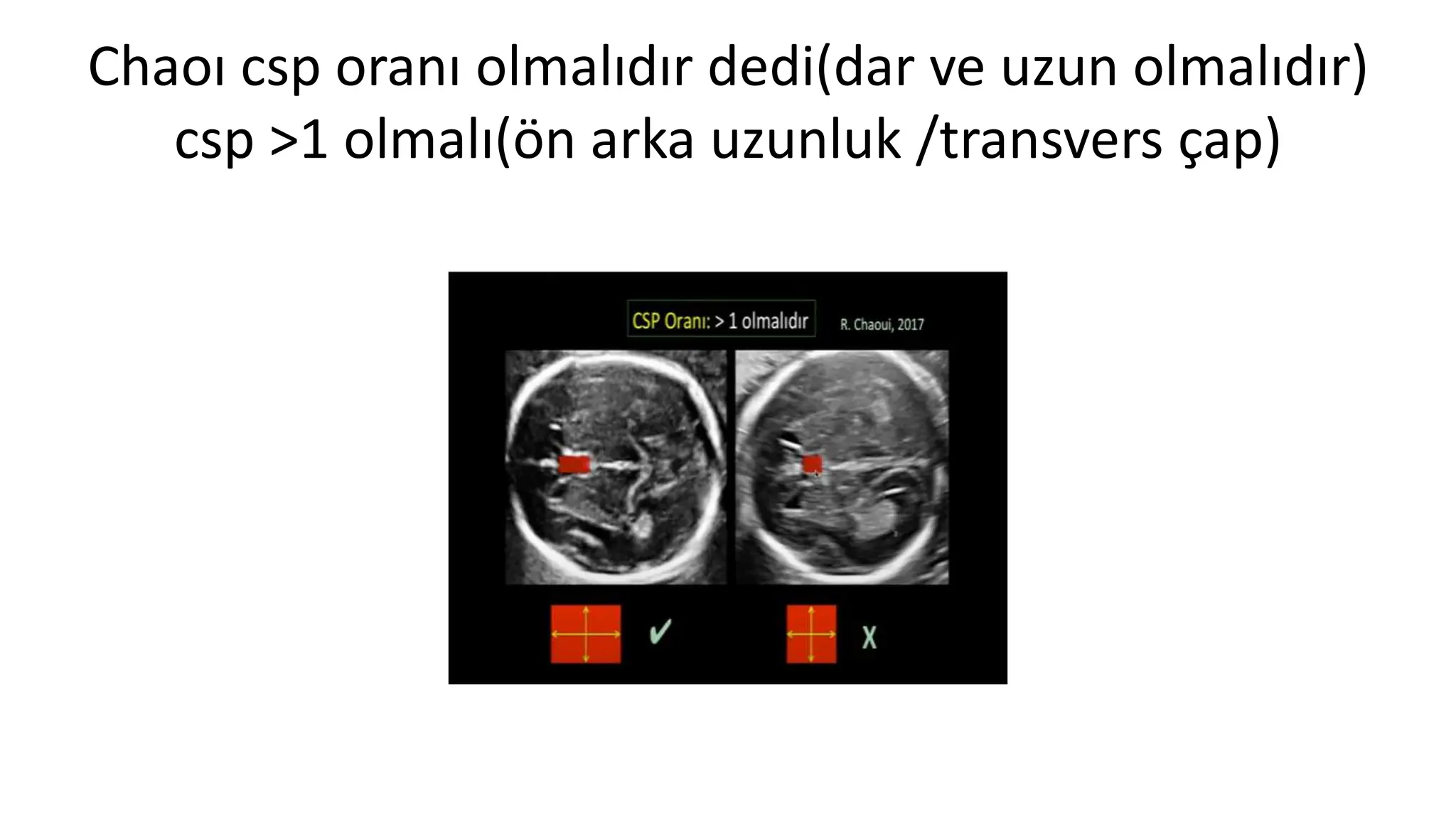 FETAL BEYİN CSP.pptx